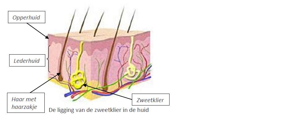 Overmatig transpireren - Hyperhidrose