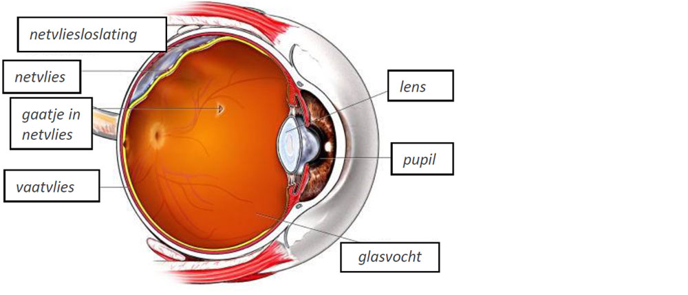 Netvliesaandoeningen en netvliesoperatie
